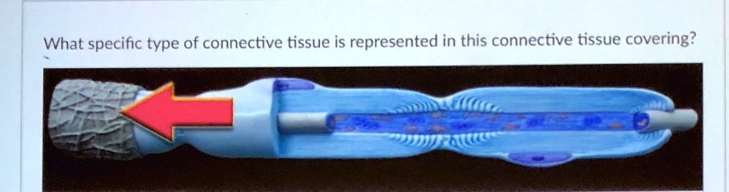 SOLVED: '49. What specific type of connective tissue is represented in ...