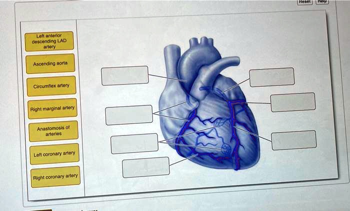 SOLVED: Left anterior descending artery Ascending aorta Circumflex artery Right marginal artery ...