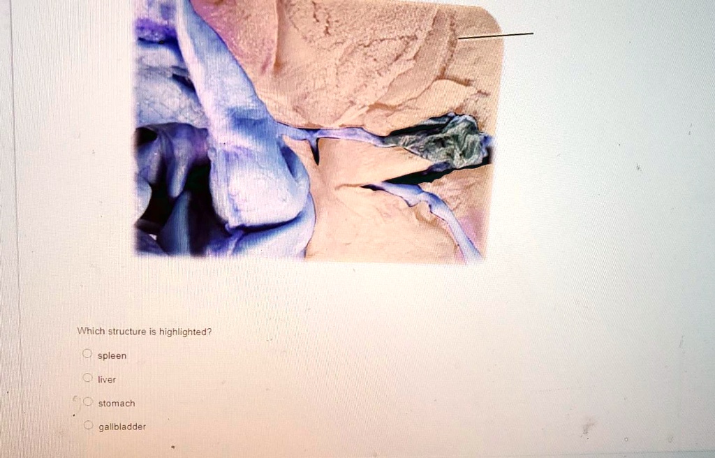 SOLVED: which structure is highlighted? Which structure is highlighted ...