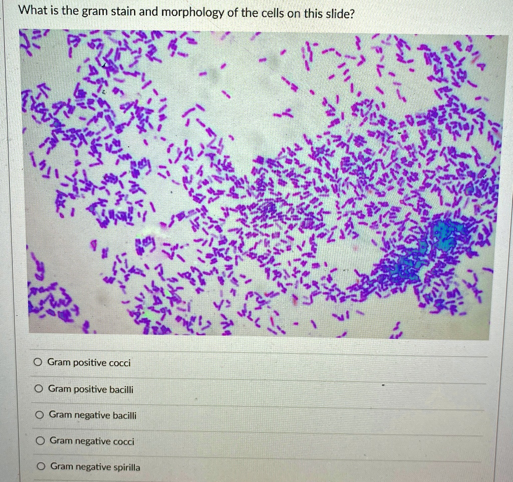 What is the gram stain and morphology of the cells on this slide? Gram positive cocci Gram ...