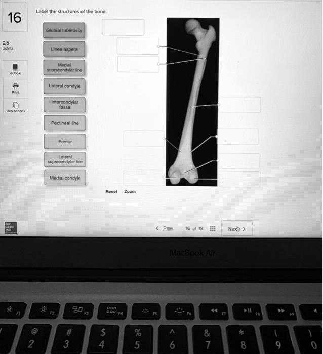 label the structures of the bone 16 glutoal tuberosi 05 polnts linea ...