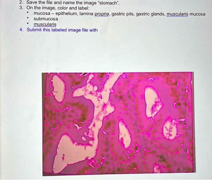 2. Save the file and name the image "stomach". 3. On the image, color ...