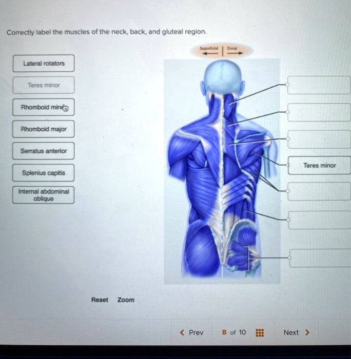 SOLVED: Correctly label the muscles of the neck, back, and gluteal ...