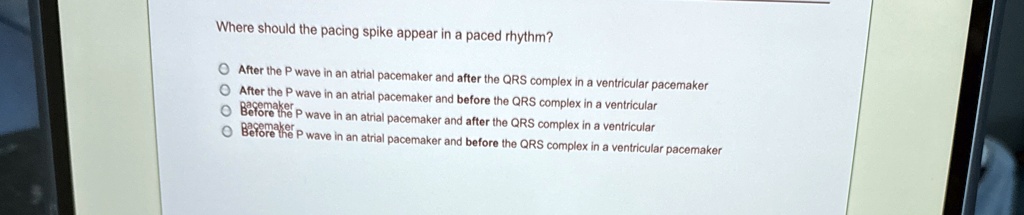 where should the pacing spike appear in a paced rhythm after the p wave ...