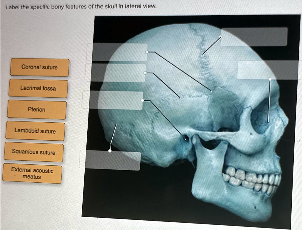 Label the specific bony features of the skull in lateral view ... Label the specific bony features of the skull in lateral view ...