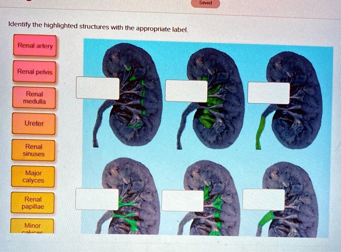 [GET ANSWER] Saved Identify the highlighted structures with the ...