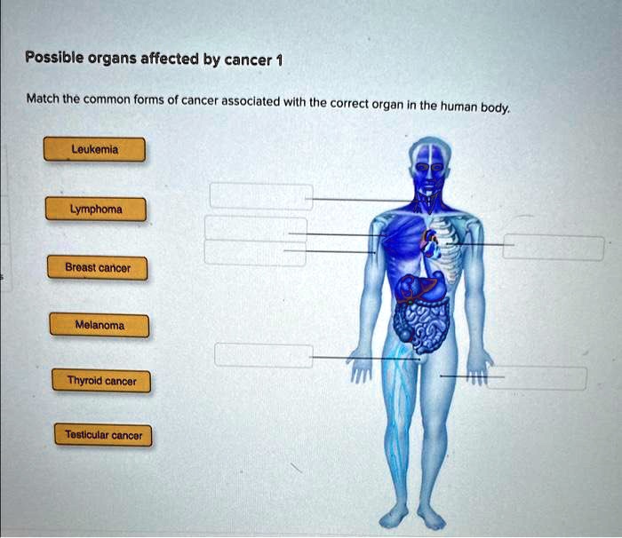 SOLVED: What's up Chegg? Possible organs affected by cancer: Match the ...