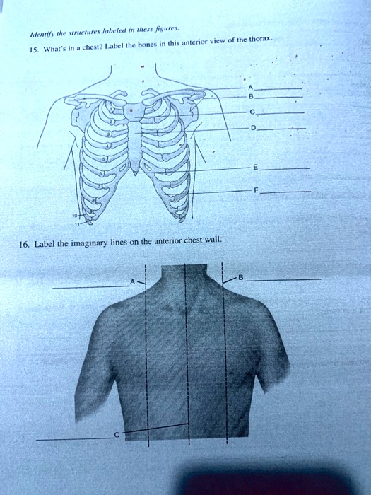 SOLVED: Identify the structures labeled in these figures. 15. What's in a chest? Label the bones ...