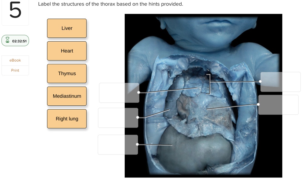 5 Label the structures of the thorax based on the hints provided. Liver 02:32:51 Heart eBook ...