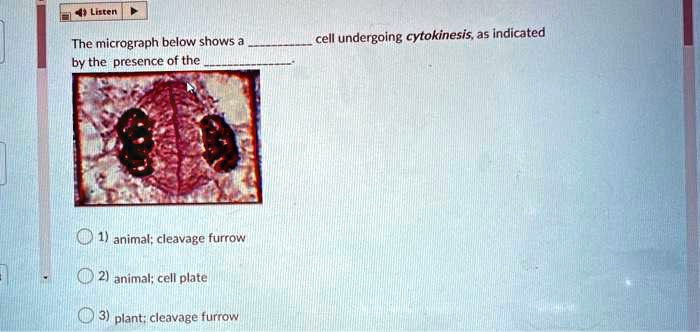 the micrograph below shows by the presence of the cell undergoing cytokinesis as indicated 0 1 ...