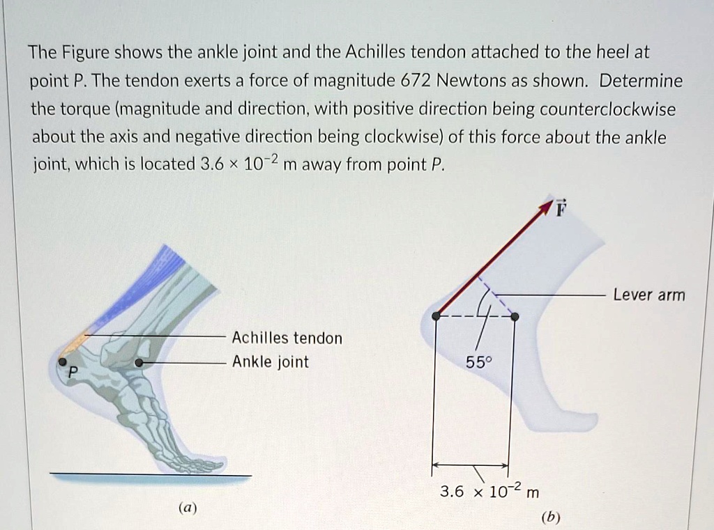 The Figure shows the ankle joint and the Achilles tendon attached to ...