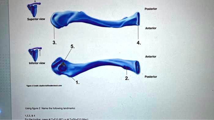 SOLVED: Posterior Superior view Anterior 4 Anterior Inferior view ...