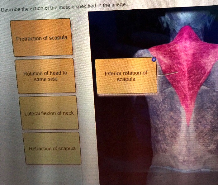 Describe the action of the muscle specified in the image. Protraction ...