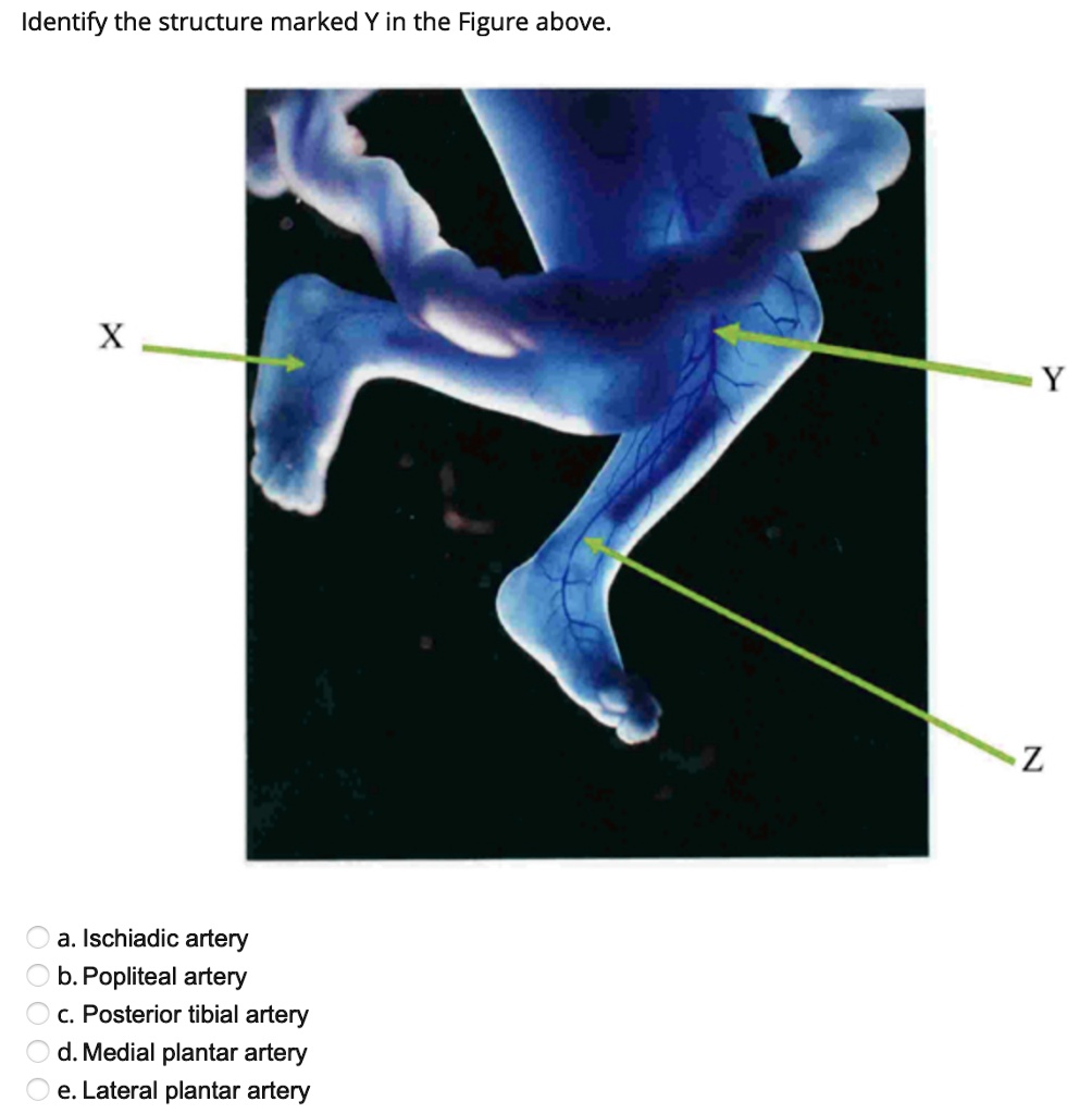 SOLVED: Identify the structure marked Y in the Figure above. X Y Z a ...