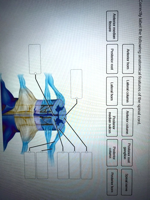SOLVED: Fissure Anterior median Posterior root Anterior horn Lateral ...