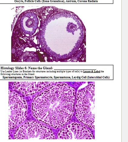 SOLVED: Where is Oocyte, Follicle Cells (Zona Granulosa), Antrum ...