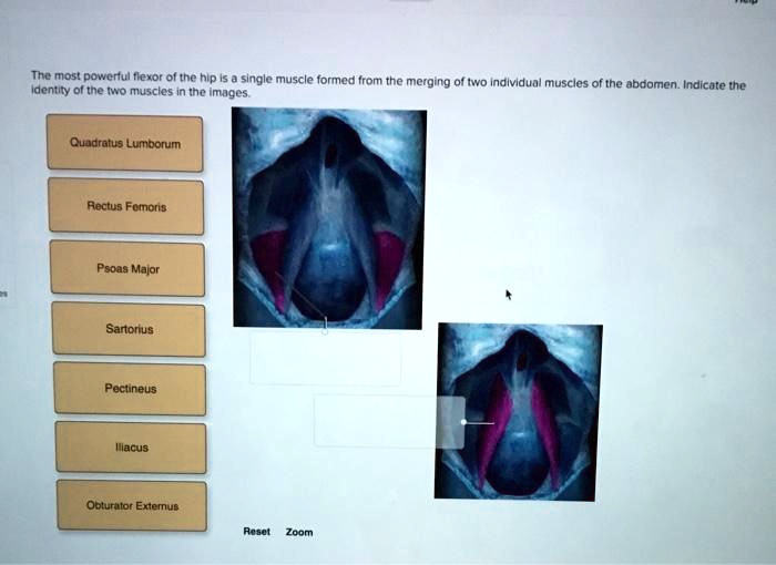 The most powerful flexor of the hip is a single muscle formed from the ...