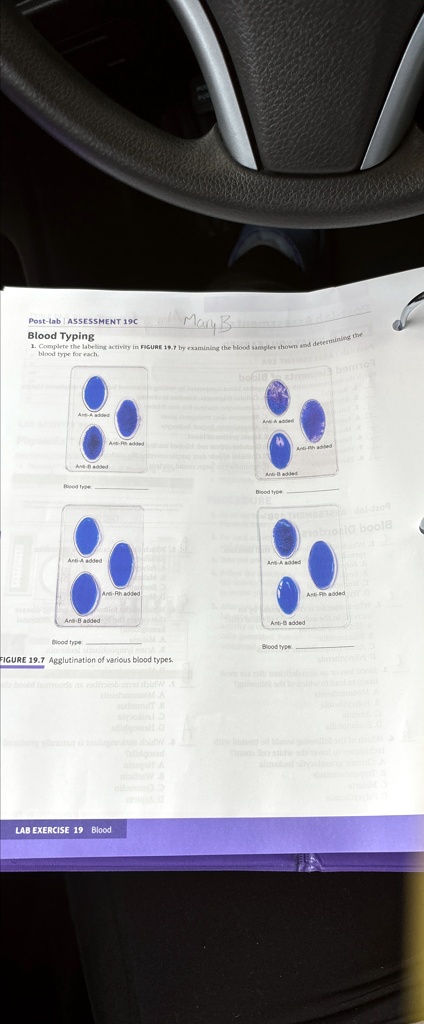 Post-lab ASSESSMENT 19C Mary B Blood Typing 1. Complete the labeling activity in FIGURE 19.7 by ...