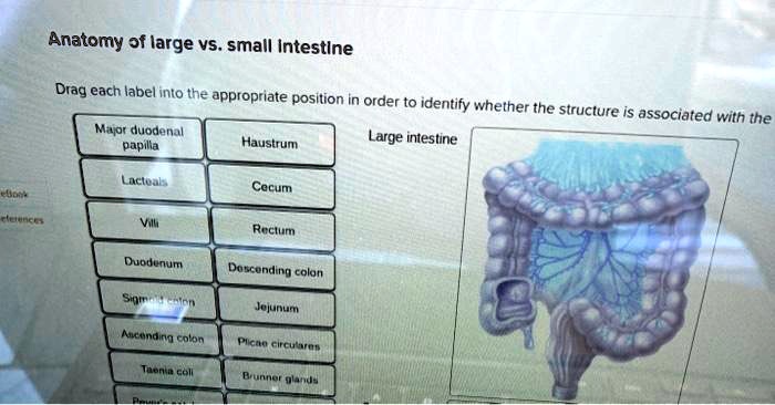 SOLVED: Anatomy of large vs.small intestine Drag each label into the ...