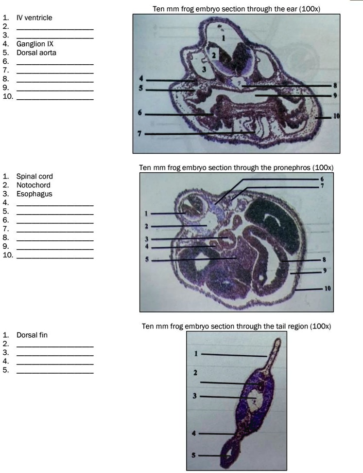 Label the structures of the late embryonic development of the frog ...