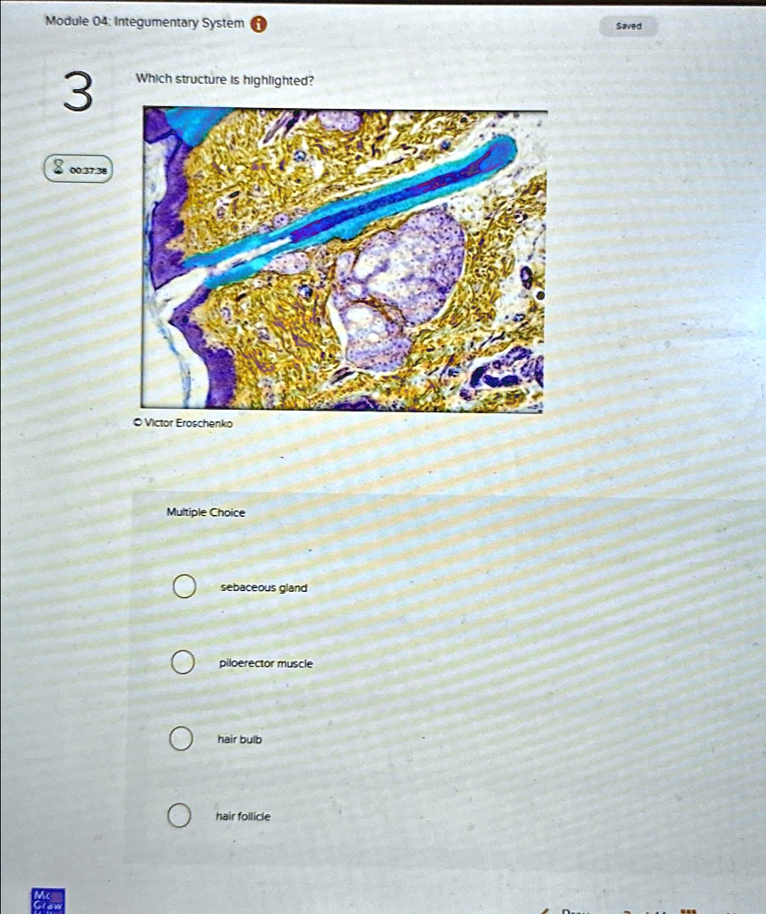 Module 04: Integumentary System 3 Which structure is highlighted? 00:37 ...