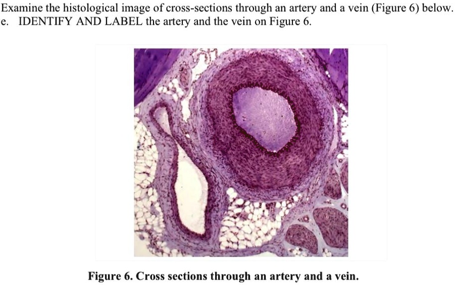 Examine the histological image of cross-sections through an artery and ...