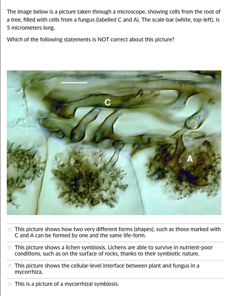 Lichen Under Microscope Labeled