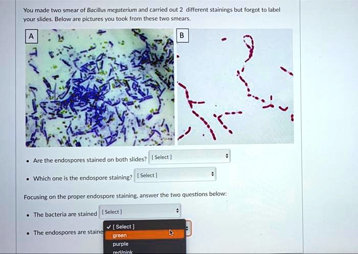 You made two smears of Bacillus megaterium and carried out 2 different ...