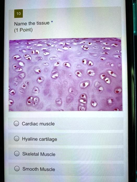 SOLVED: 10 Name the tissue Point) Cardiac muscle Hyaline cartilage ...