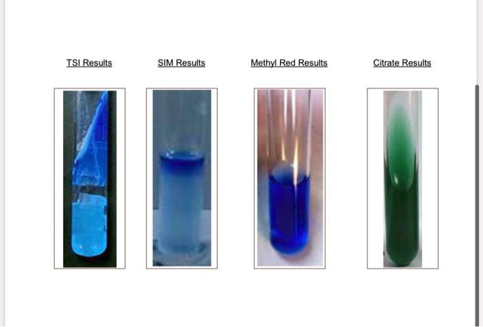 SOLVED: Gram-negative possibilities: Interpretation of results ...