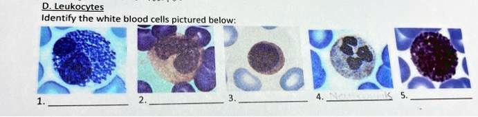SOLVED: 1-5 are types of white blood cells they must be identified ...