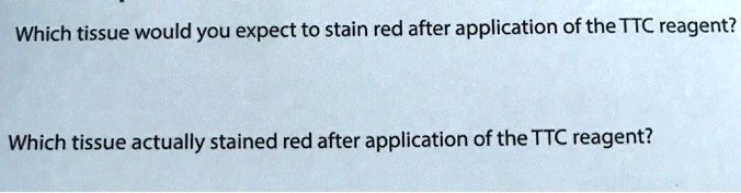 SOLVED:Which tissue would you expect to stain red after application of ...