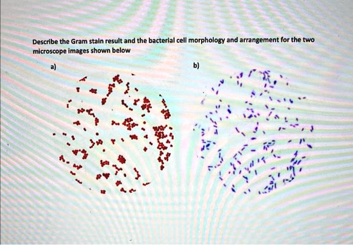 [GET ANSWER] Describe the Gram stain result and the bacterial cell morphology and arrangement ...