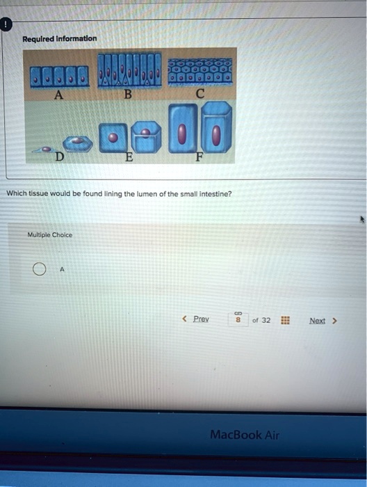 SOLVED: Which tissue would be found lining the lumen of the small ...