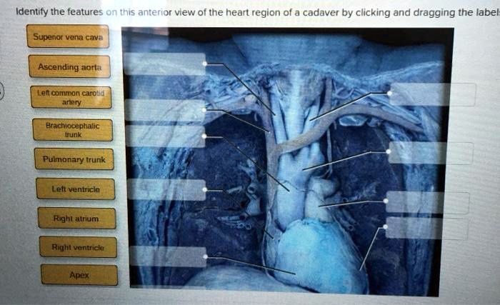 Identify the features on this anterior view of the heart region of a ...