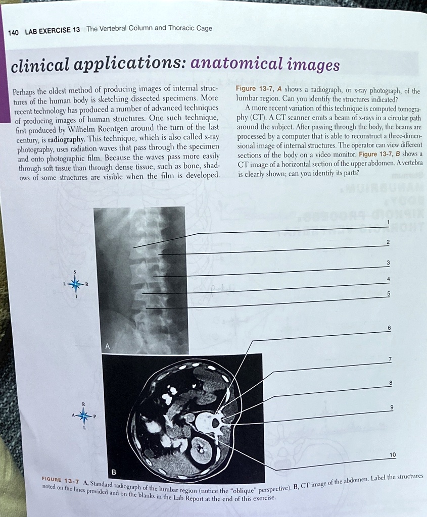 140 LAB EXERCISE 13 The Vertebral Column and Thoracic Cage clinical ...