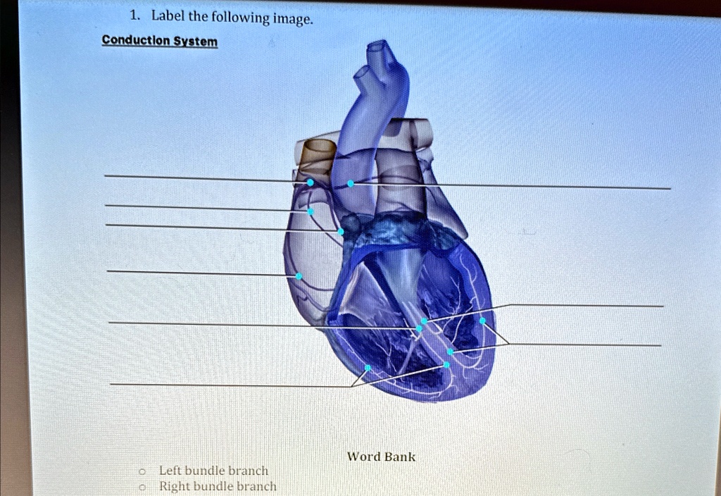[GET ANSWER] 1. Label the following image. Conduction System O Word ...