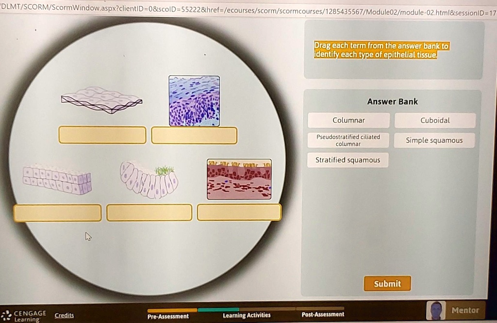 Drag each term from the answer bank to identify each type of epithelial ...