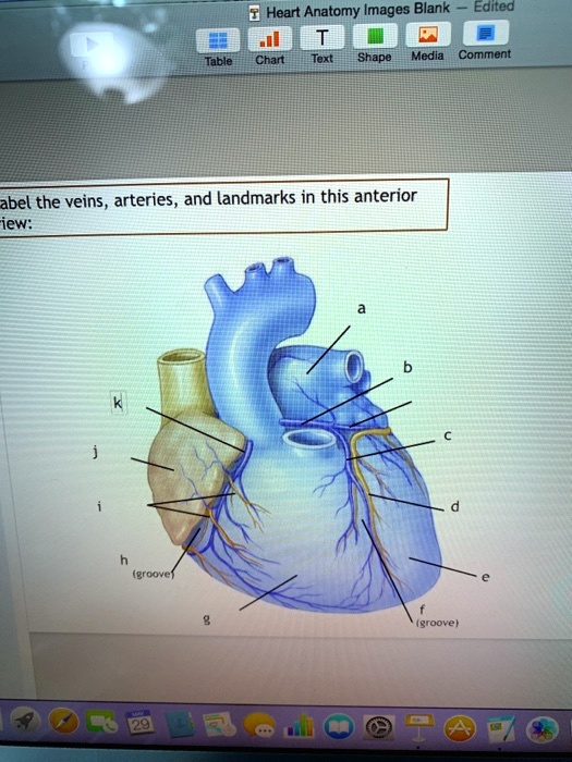 Label the veins, arteries, and landmarks in this anterior...