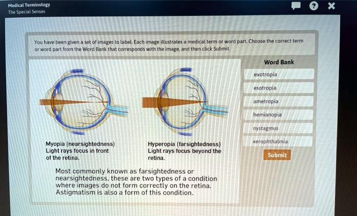 Xerophthalmia Pronunciation Words
