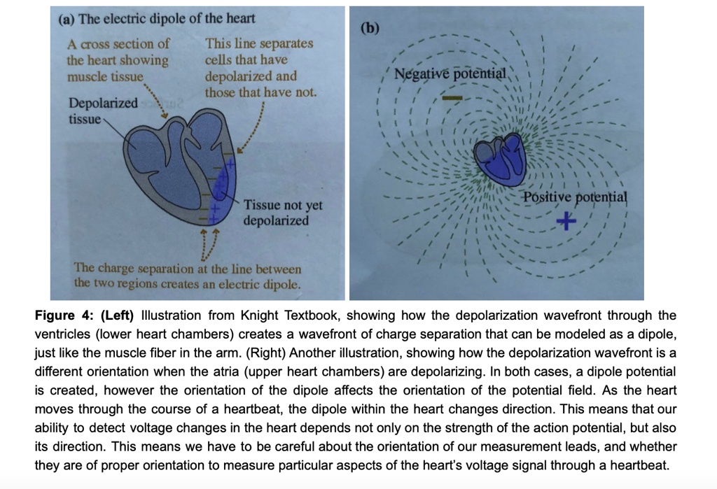 (a) The electric dipole of the heart A cross section of the heart ...
