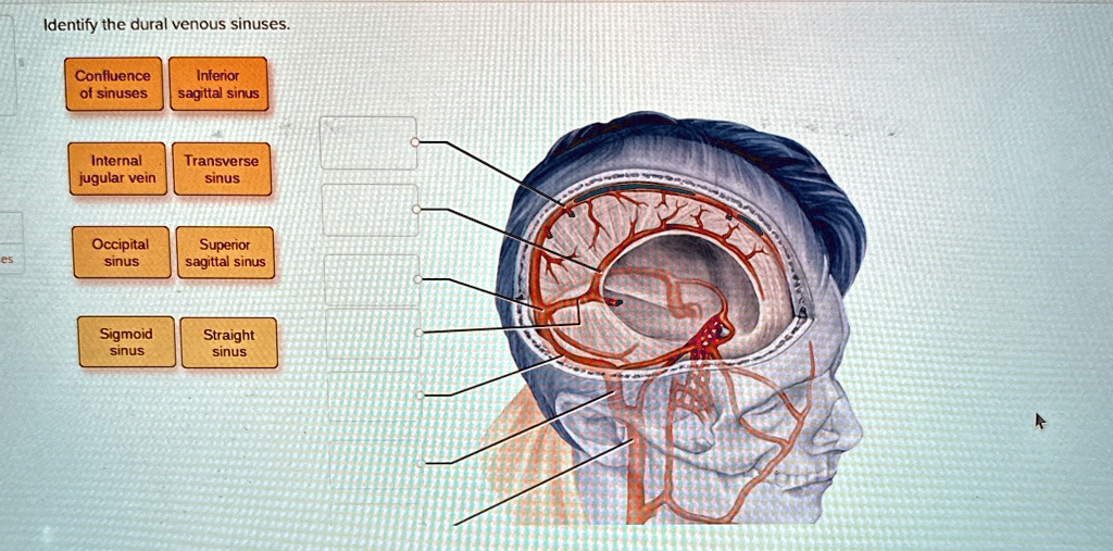 identify the dural venous sinuses confluence of sinuses inferior ...