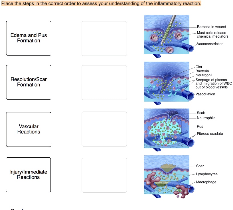 SOLVED: Place the steps in the correct order to assess your ...