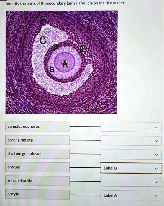 SOLVED: Identify the parts of the secondary (antral) follicle on the ...