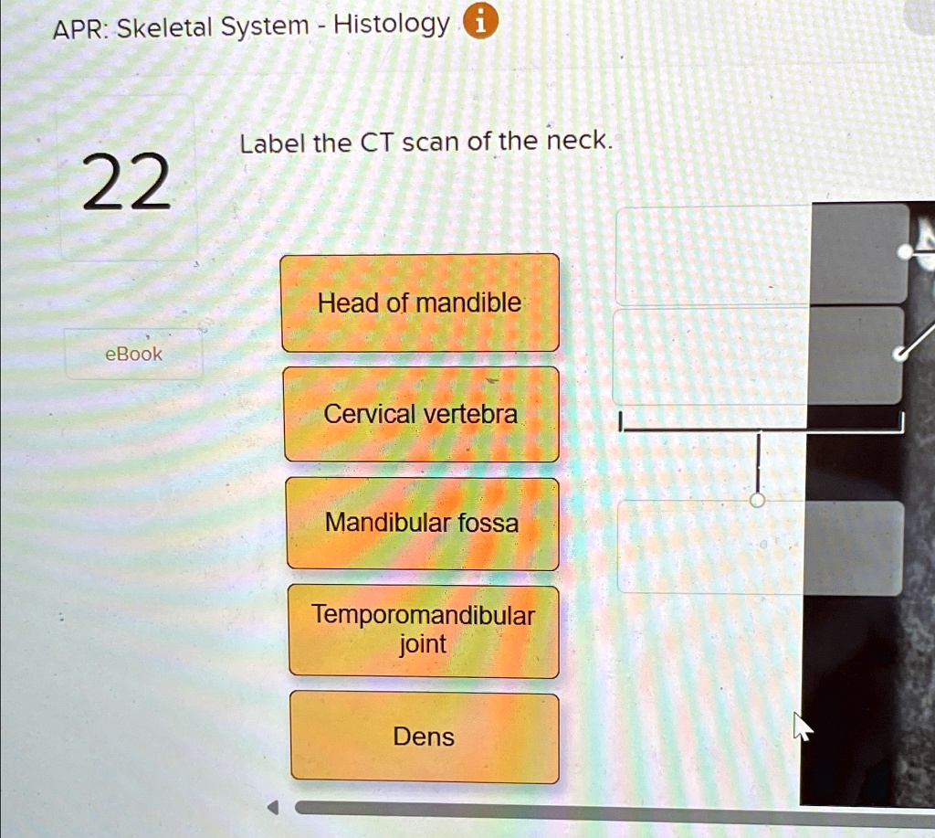 APR: Skeletal System - Histology 1 Label the CT scan of the neck. 22 ...