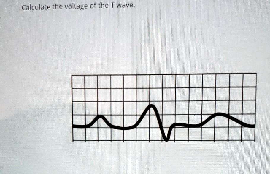 SOLVED: Calculate the voltage of the Twave