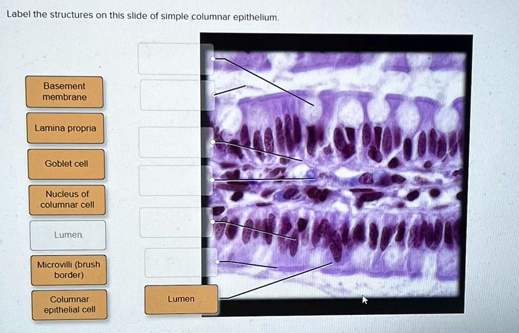 Simple Columnar Epithelium Features Label the features of simple ...