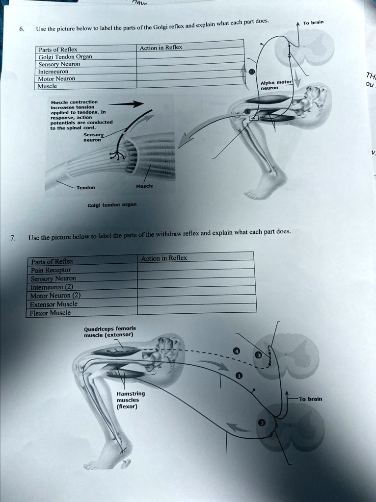 6 use the picture below to label the parts of the golgi reflex and ...