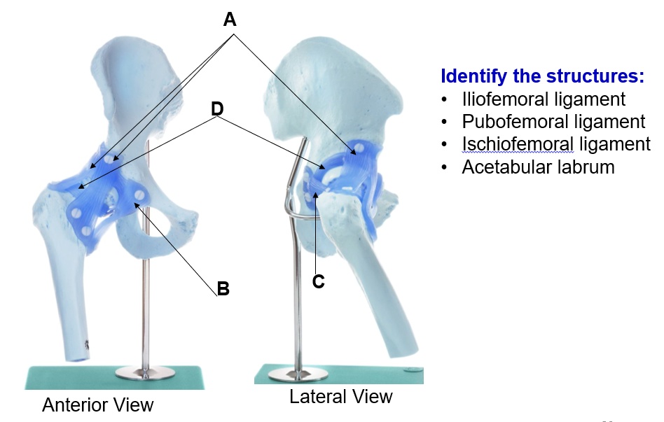 A • D • C B Lateral View Anterior View Identify the structures ...
