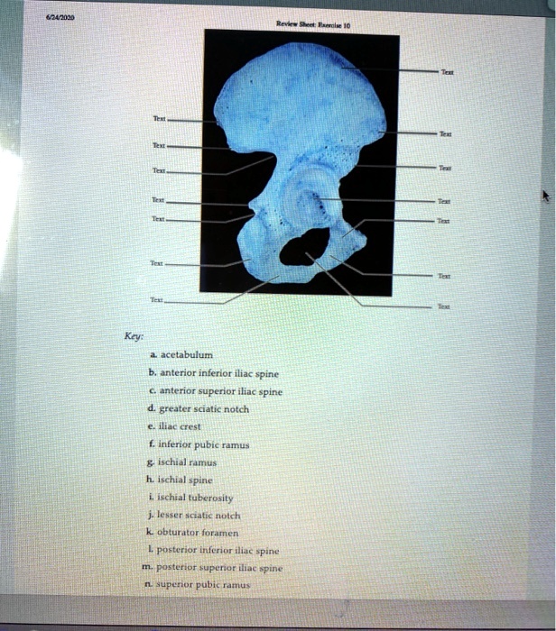 SOLVED: acetabulum unienor inferior iliac spine Anieriom superior iliac ...